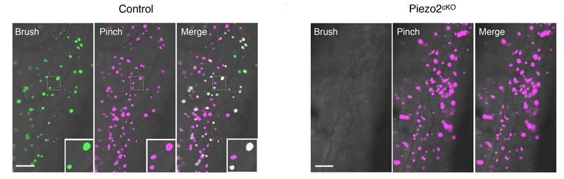 When Normal Touch Becomes Painful, the Same Neurons Are Involved | The ...