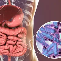 Fecal Transplant | The Scientist