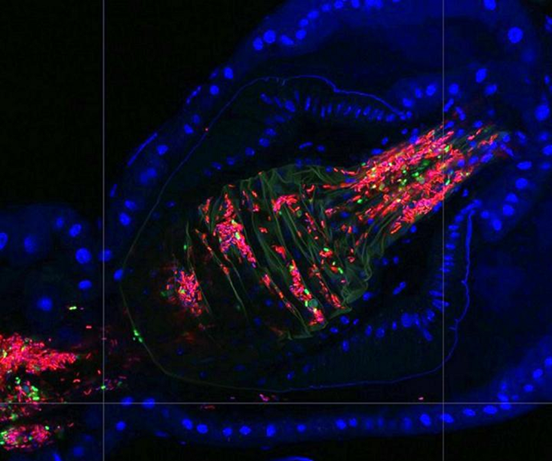 Image of the Day: Gut Bomb | The Scientist