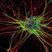 Stem Cell–Derived Neurons from People with Autism Grow Differently ...
