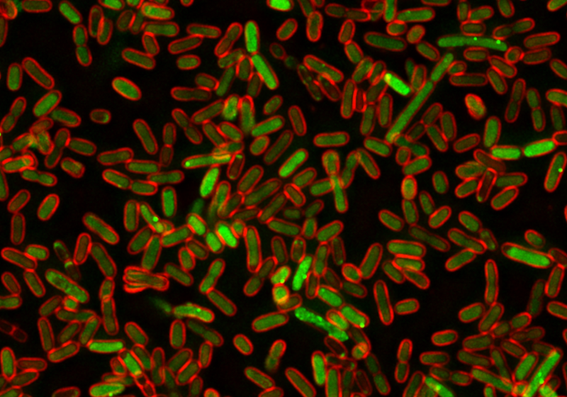 Image of the Day: Sentinel Cells | The Scientist