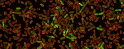 Image of the Day: Sentinel Cells | The Scientist