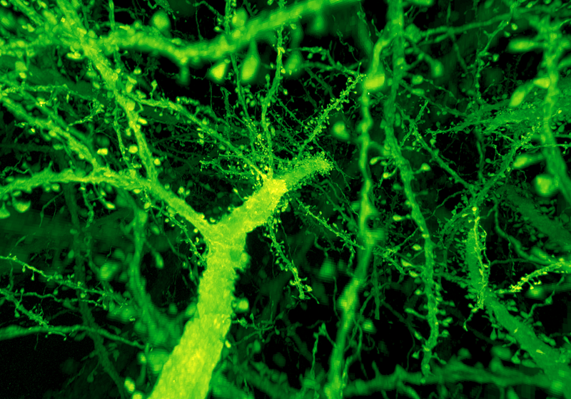 New Technique Captures Entire Fly Brain in 3D | The Scientist