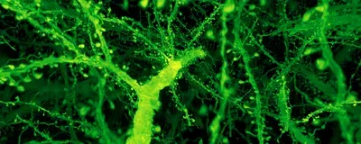 New Technique Captures Entire Fly Brain in 3D | The Scientist