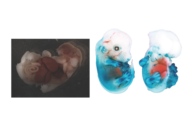 Mutations in One Gene Linked to Two Separate Birth Defects | The Scientist