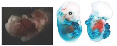 Mutations in One Gene Linked to Two Separate Birth Defects | The Scientist