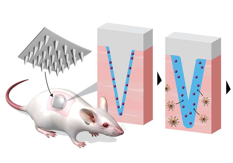 Stick-On Immune Cell Monitor | The Scientist
