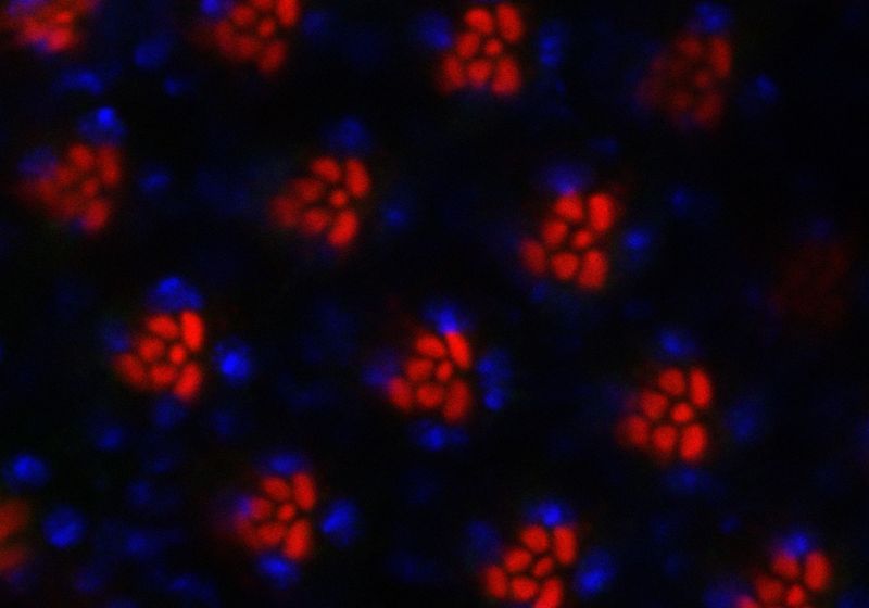 Image of the Day: In the Eye of a Fly | The Scientist