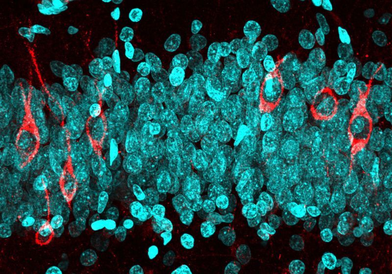 More Evidence that Humans Do Appear to Create New Neurons in Old Age ...