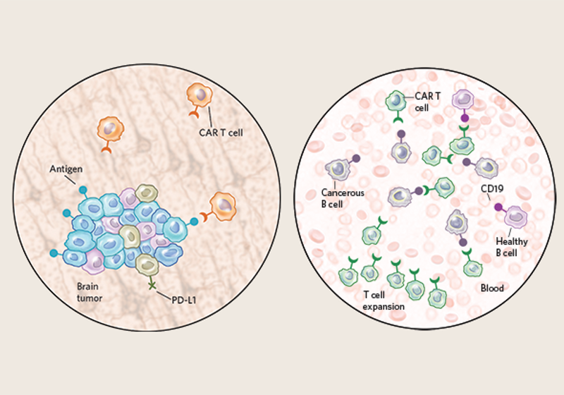Infographic: CAR-T Cells in Solid Versus Liquid Cancers | The Scientist