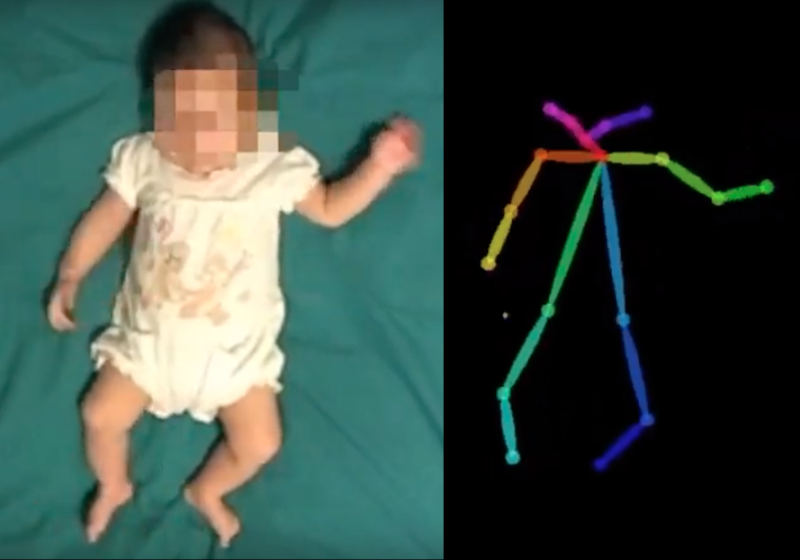 Image of the Day: Wiggles and Squirms | The Scientist