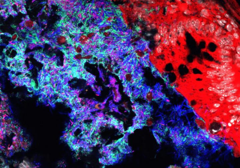 Image of the Day: Microbes At War | The Scientist