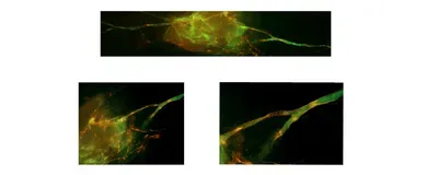 Lab-Generated Lymph Nodes Connect to Lymphatic System in Mice | The ...