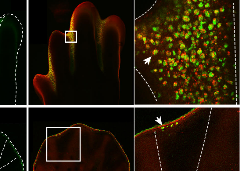 Image of the Day: Phantom Limbs | The Scientist