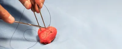 How 3-D Printing Could Help Shape Surgery | The Scientist