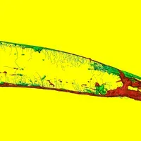 C. Elegans | The Scientist