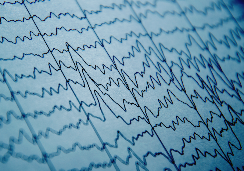 Opinion: Test Brain-Reviving Technology in Infants First | The Scientist