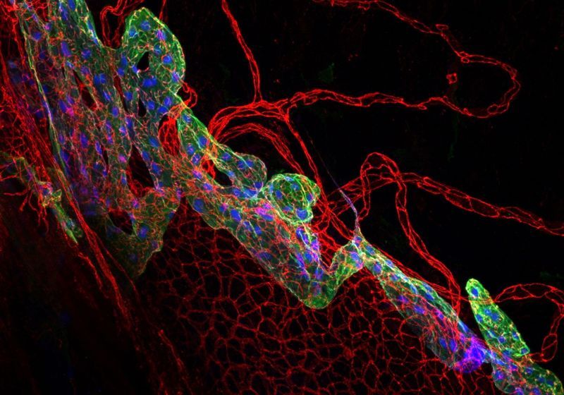 Brain’s Fluid Drains via Lymphatic Vessels at the Base of the Skull ...
