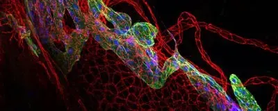 Brain’s Fluid Drains via Lymphatic Vessels at the Base of the Skull ...