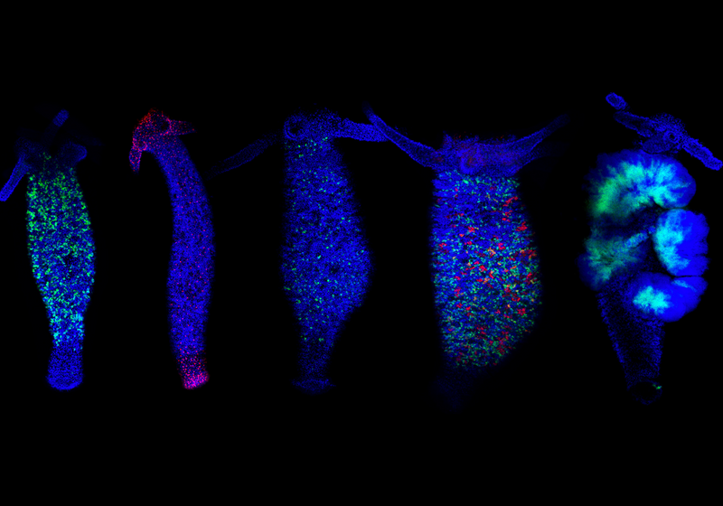 Image of the Day: Expressive Hydra | The Scientist