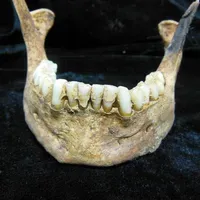 Teeth | The Scientist