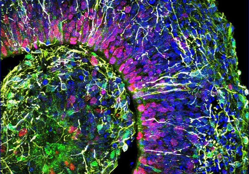 Human Cortical Organoids Model Neuronal Networks | The Scientist
