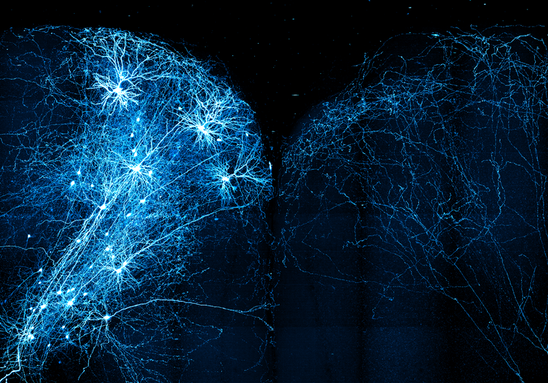 Image of the Day: Brain Map | The Scientist