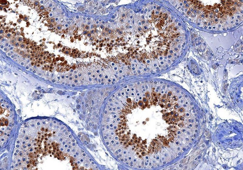 Human Testicles Contain Endocannabinoid System Components | The Scientist