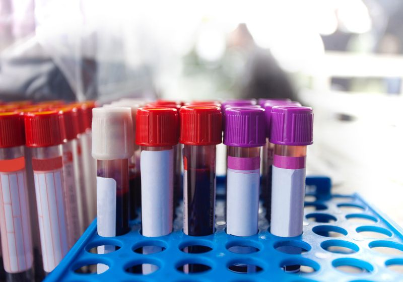 Shuping Wang, Public Health Whistleblower, Dies | The Scientist