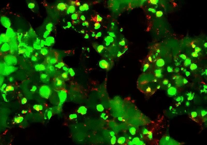 Image Of The Day Tau Aggregation The Scientist