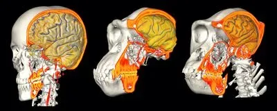 Image of the Day: Brains and Braincases | The Scientist