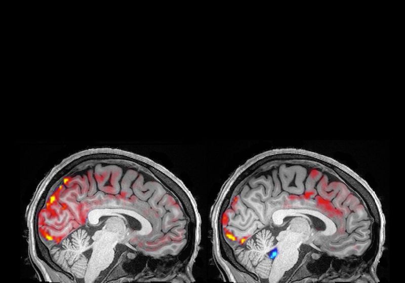 Waves of Fluid Bathe the Sleeping Brain, Perhaps to Clear Waste | The ...