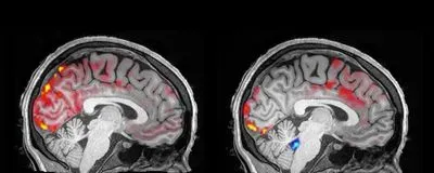 Waves of Fluid Bathe the Sleeping Brain, Perhaps to Clear Waste | The ...