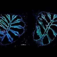 Traumatic Brain Injury | The Scientist