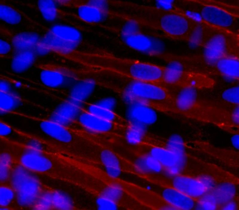 Paper to EBR in 9 Months: How a Strong Collaboration Leads to Project ...