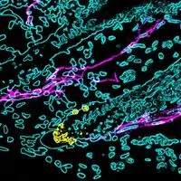 Stress Turns Hair Gray By Depleting Pigment-Producing Stem Cells | The ...