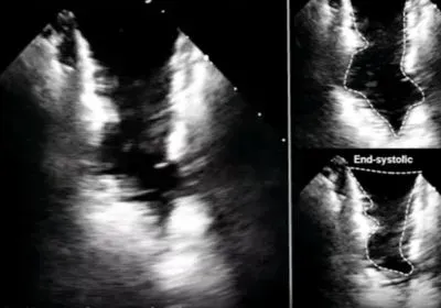 Image of the Day: Bionic Heart | The Scientist