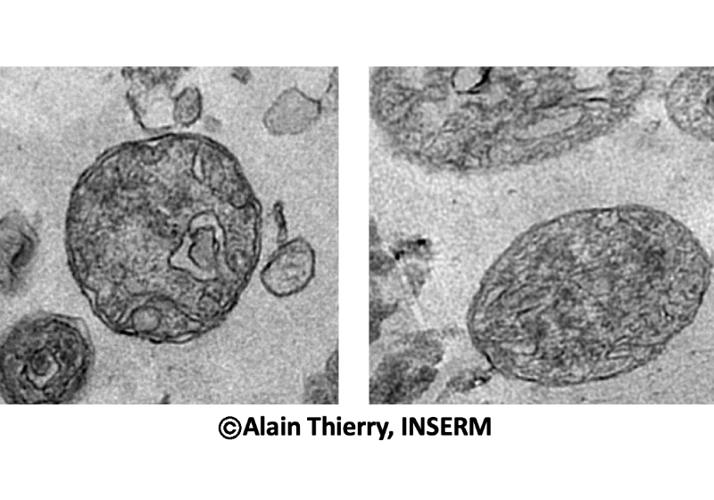 Researchers Find Cell-Free Mitochondria Floating in Human Blood | The ...