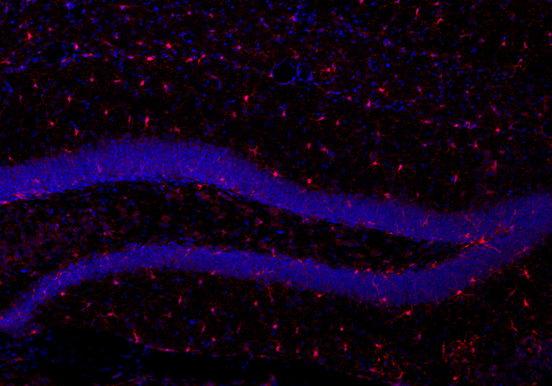 Image of the Day: Memory Erasure | The Scientist
