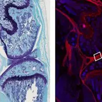 Image of the Day: Scorpion Venom for Arthritis | The Scientist