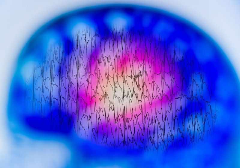 Artificial Intelligence Decodes Speech from Brain Activity: Study | The ...