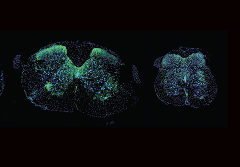 Image of the Day: Muting Muscle Spasms | The Scientist