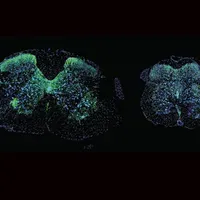 Image of the Day: Muting Muscle Spasms | The Scientist