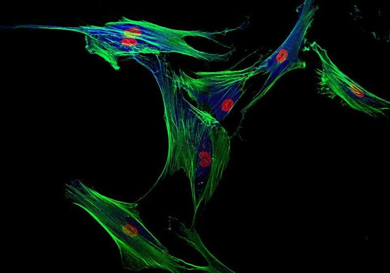 Two Studies Question Function of Bone Hormone Osteocalcin | The Scientist