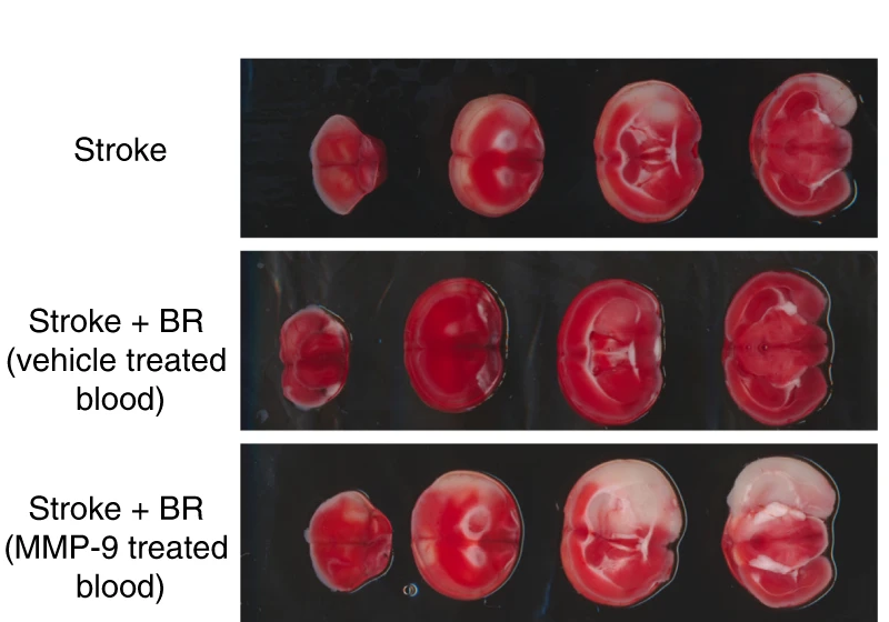 Blood Replacement Rescues Mice from Stroke Damage | The Scientist