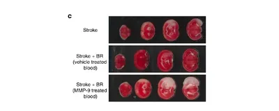 Blood Replacement Rescues Mice from Stroke Damage | The Scientist