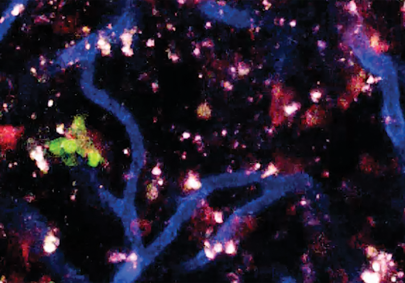 The Brain’s Immune Cells Stand Sentinel Against Viral Invasion | The ...