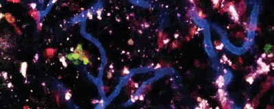 The Brain’s Immune Cells Stand Sentinel Against Viral Invasion | The ...