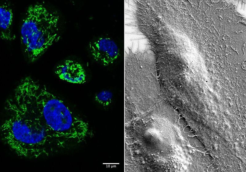 Cheese Preservative Slows Oral Cancer Spread in Mice: Study | The Scientist