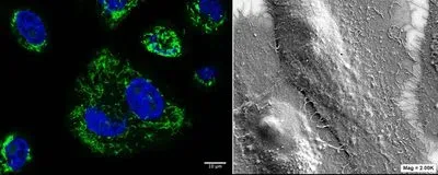 Cheese Preservative Slows Oral Cancer Spread in Mice: Study | The Scientist
